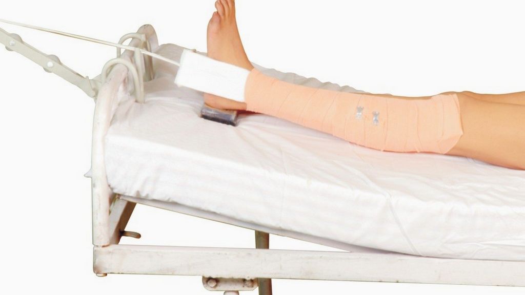 Cervical Skin Traction