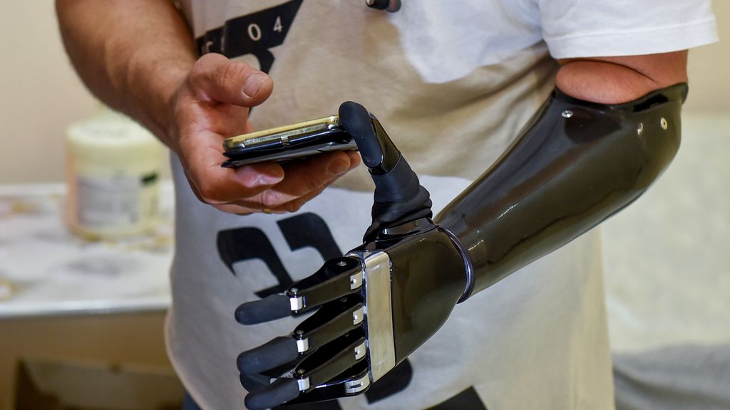 Mechanical Forequarter Prosthesis