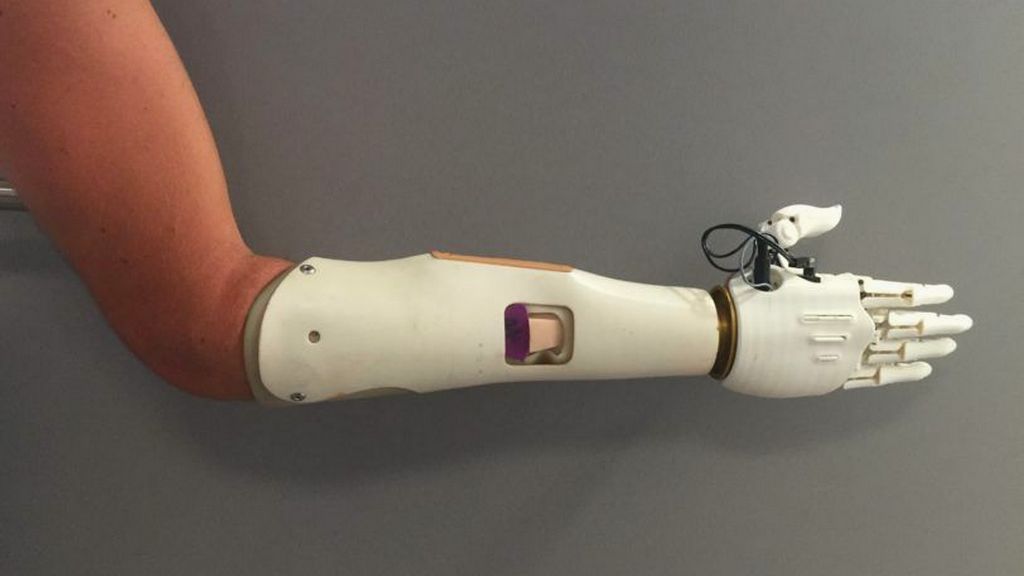 Prótesis de brazo controladas electrónicamente Miyo