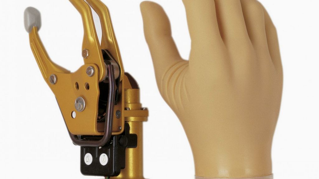 Prótesis parciales de mano