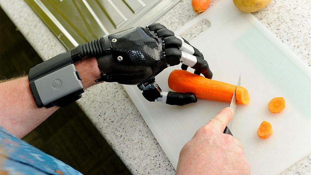 Prótesis de mano Sensor Rapid