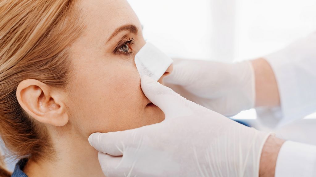 Thermoplastic Nasal Splints